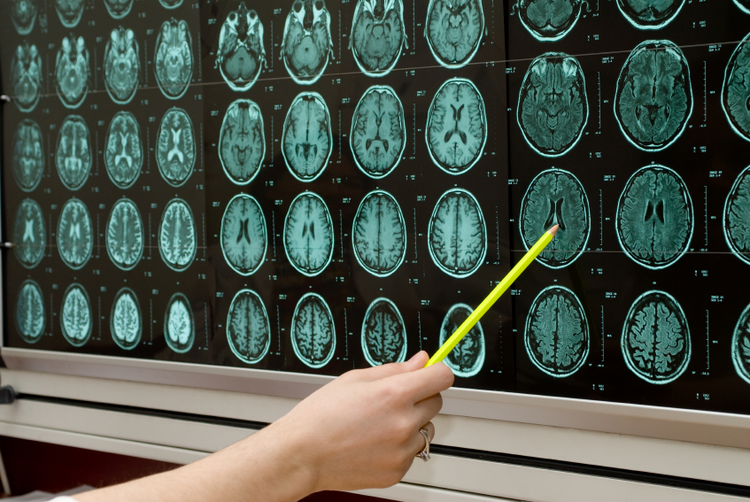 Qué es un medico radiólogo?