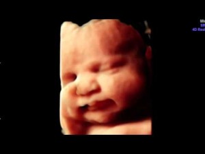 Ultrasonido 4D Hd live- Diagnóstico Especializado por Imagen